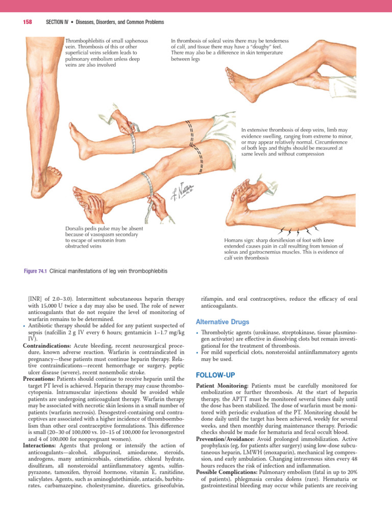 Netter's Obstetrics and Gynecology, 3rd Edition - Thrombophlebitis, Page 158 | PDF | Thrombosis ...