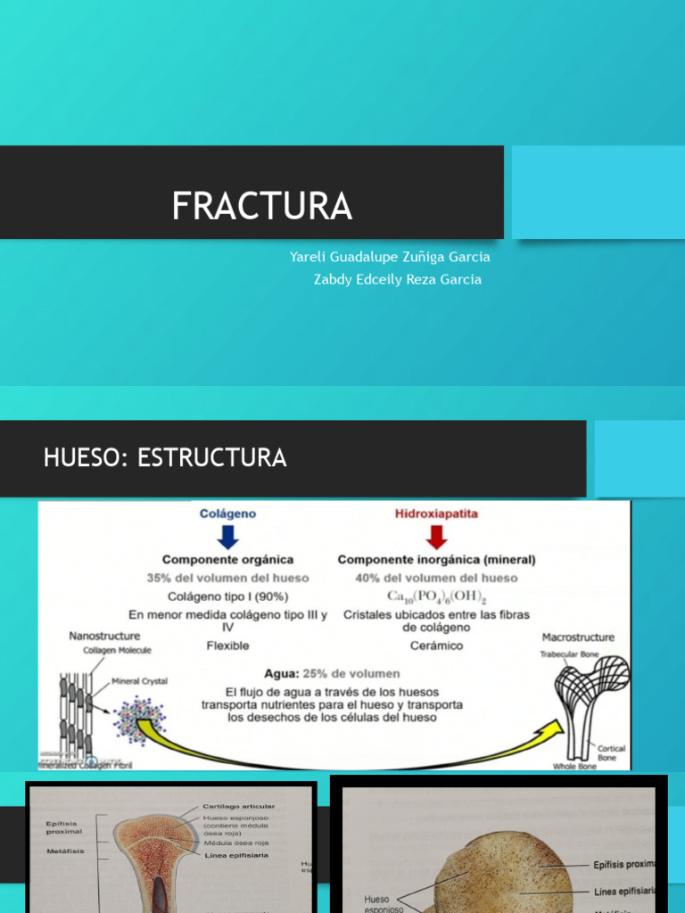 FRACTURA | PDF | Hueso | Fractura