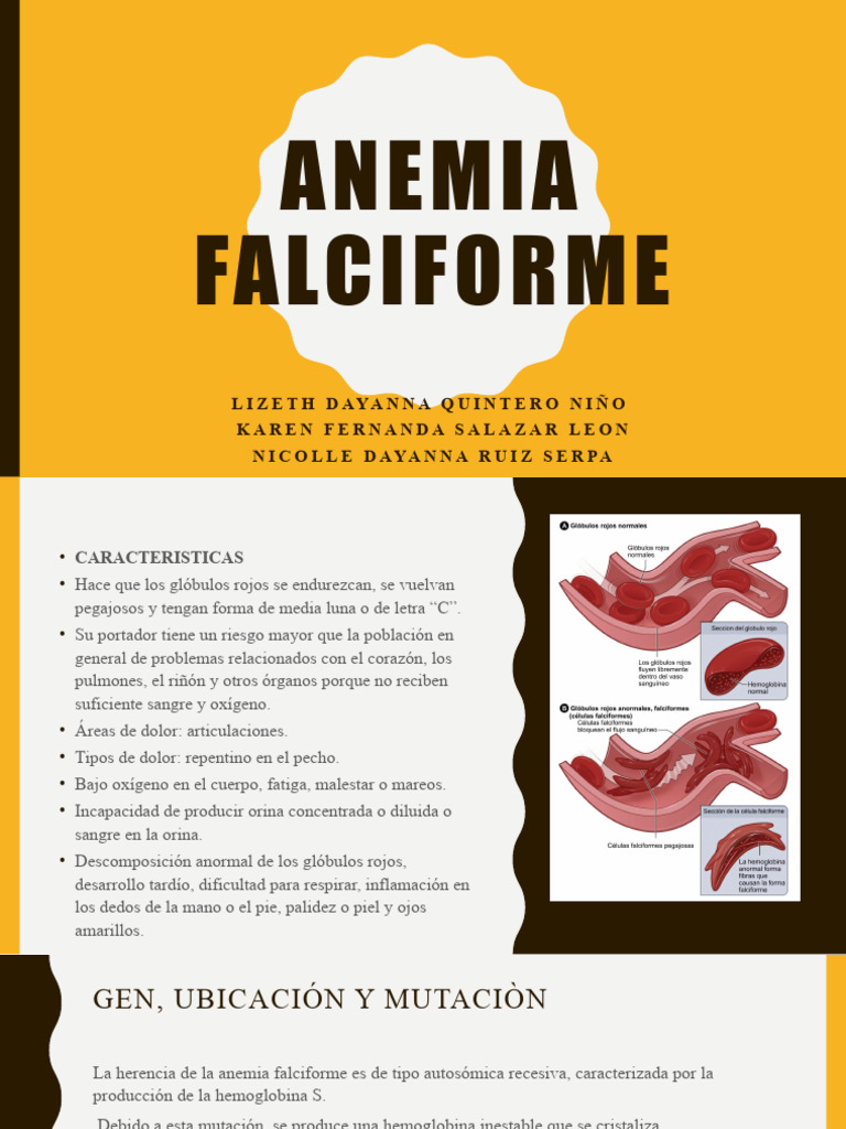 Anemia Falciforme | PDF | Epidemiología | Medicina CLINICA