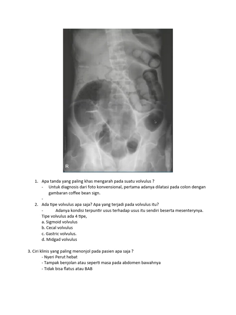 WR Volvulus | PDF