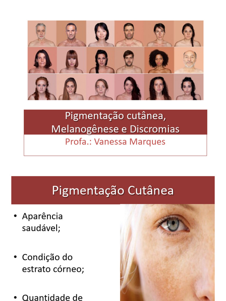 Aula - Pigmentação cutânea e discromias | PDF | Pele | Anatomia