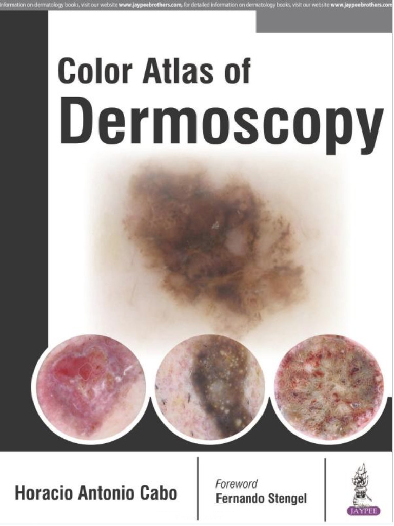 Cabo H. Color Atlas of Dermoscopy 2018 | PDF | Melanoma | Skin