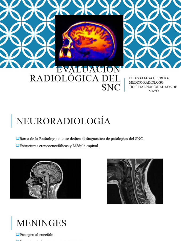 Evaluación Radiológica Del Snc | PDF | Fluido cerebroespinal | Sistema nervioso central