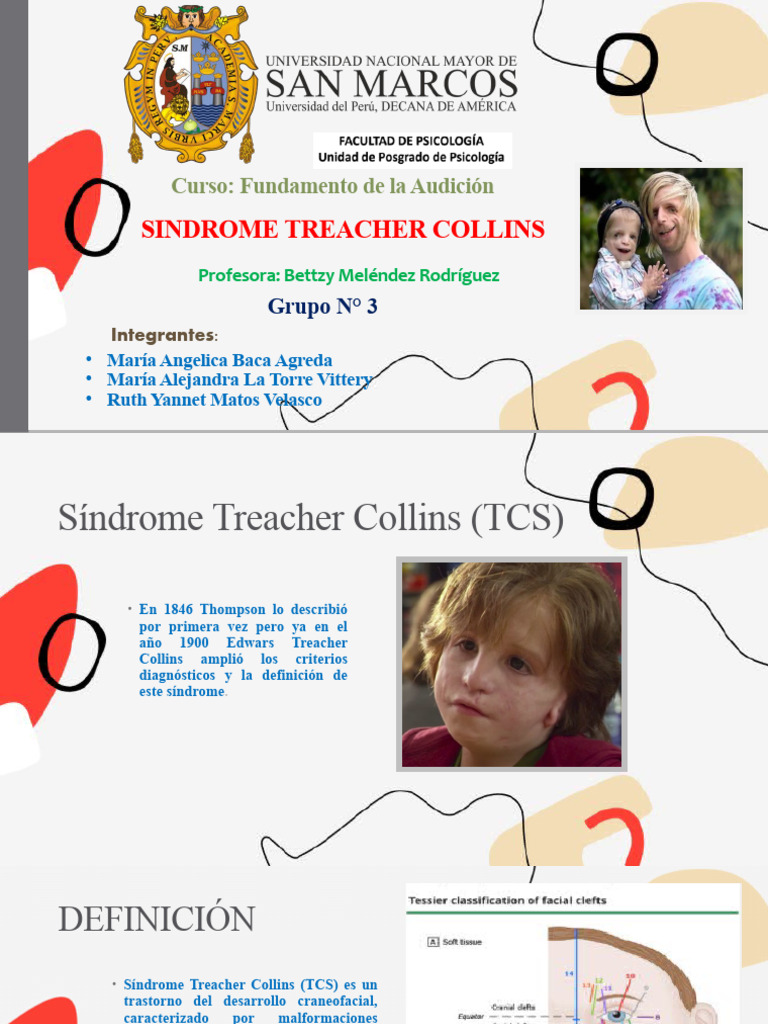 Sindrome Treacher Collins Corregido | PDF