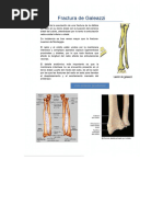 PROTOCOLO EVALUACIÓN FUERZA MUSCULAR - Escala Medical Research Council ...
