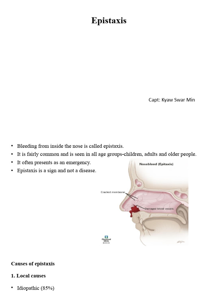 Epistaxis PowerPoint | PDF | Clinical Medicine | Medical Specialties