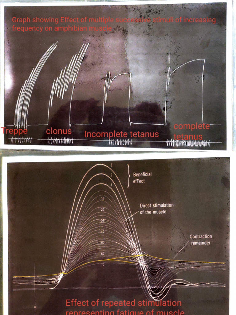 Amphibian Graphs? | PDF | Diastole | Ventricle (Heart)