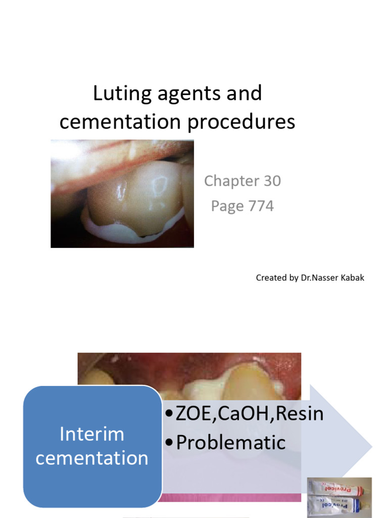 Luting Agents 2022 A | PDF | Materials | Building Engineering