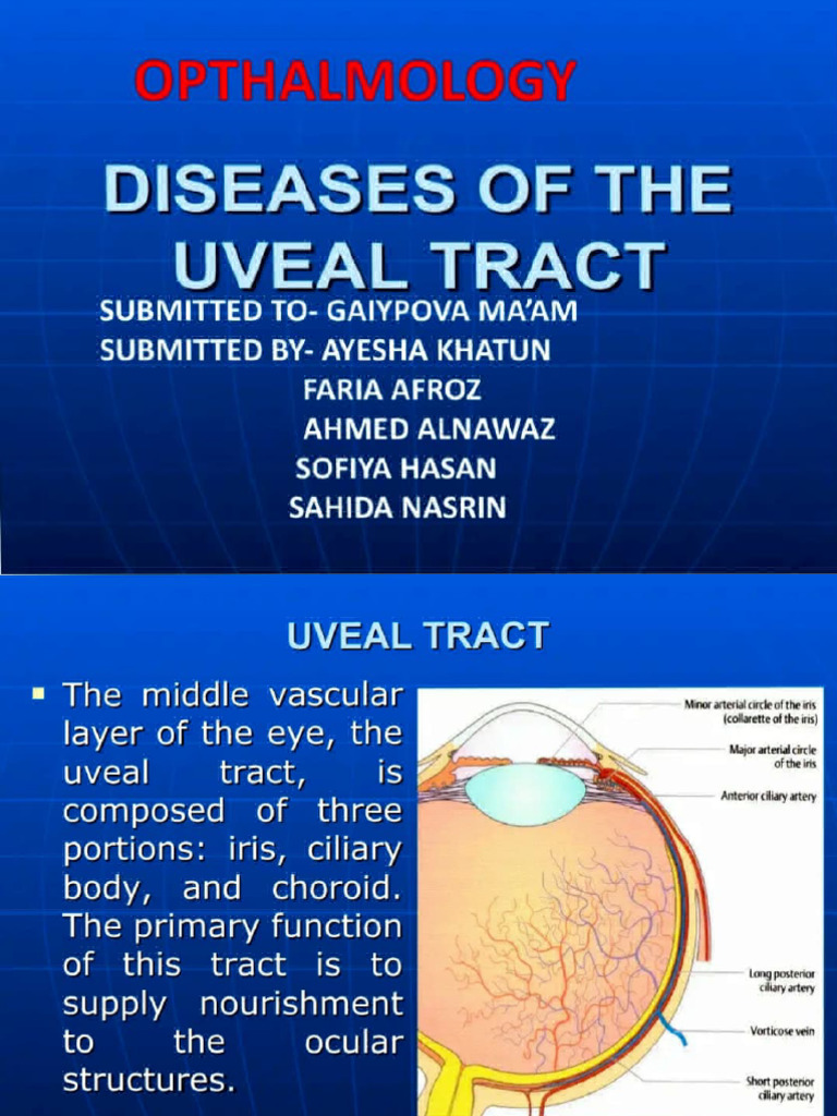Disease of Vascular Tract and Pathology of Lens | PDF