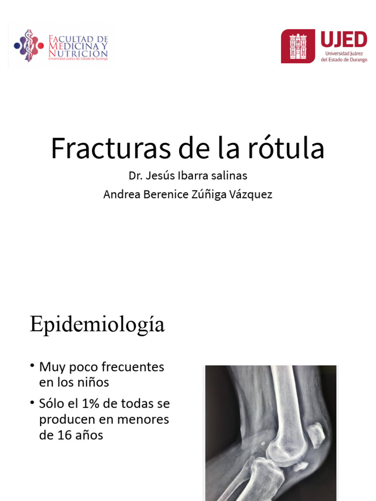 Fracturas de La Rotula | PDF