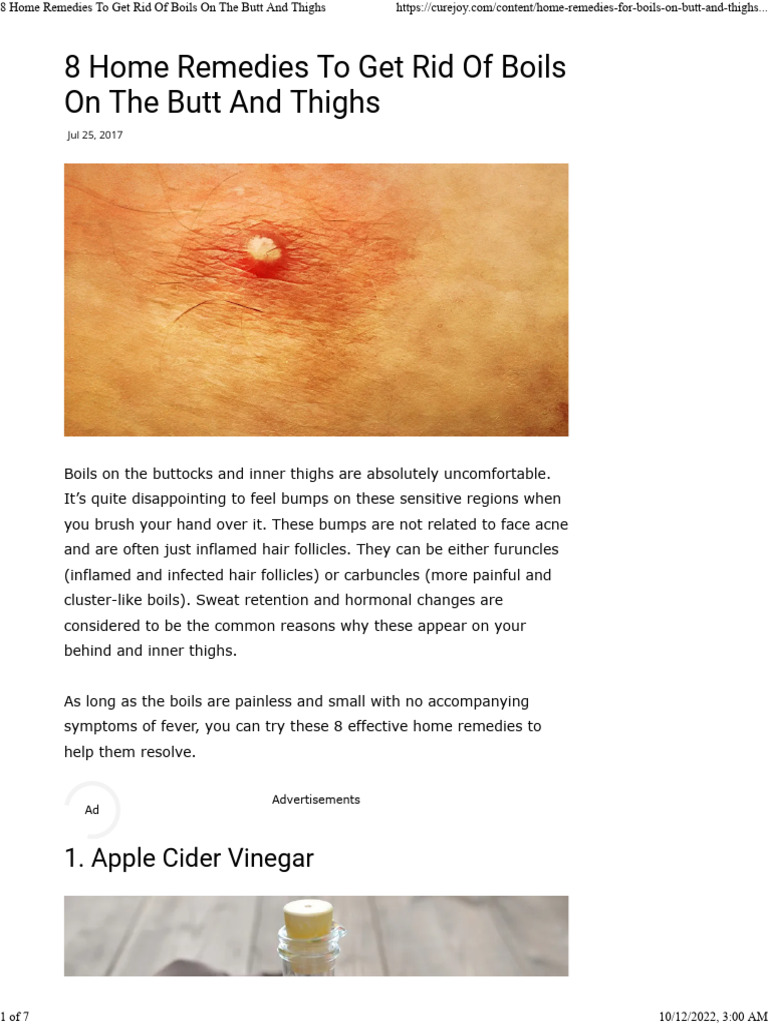 8 Home Remedies To Get Rid of Boils On The Butt and Thighs | PDF ...