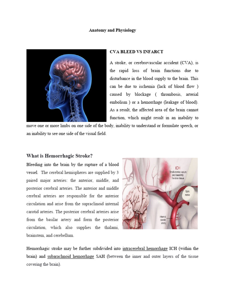 Anaphysio 9b Cva Bleed Vs Infarct | PDF | Stroke | Ischemia
