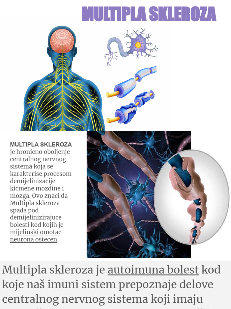 Multipla Skleroza | PDF