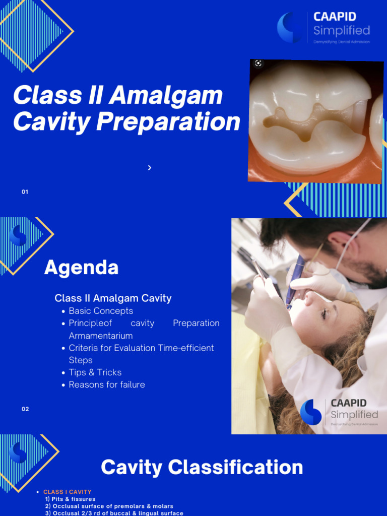 Class II Amalgam Cavity Preparation | PDF | Tooth | Dentistry