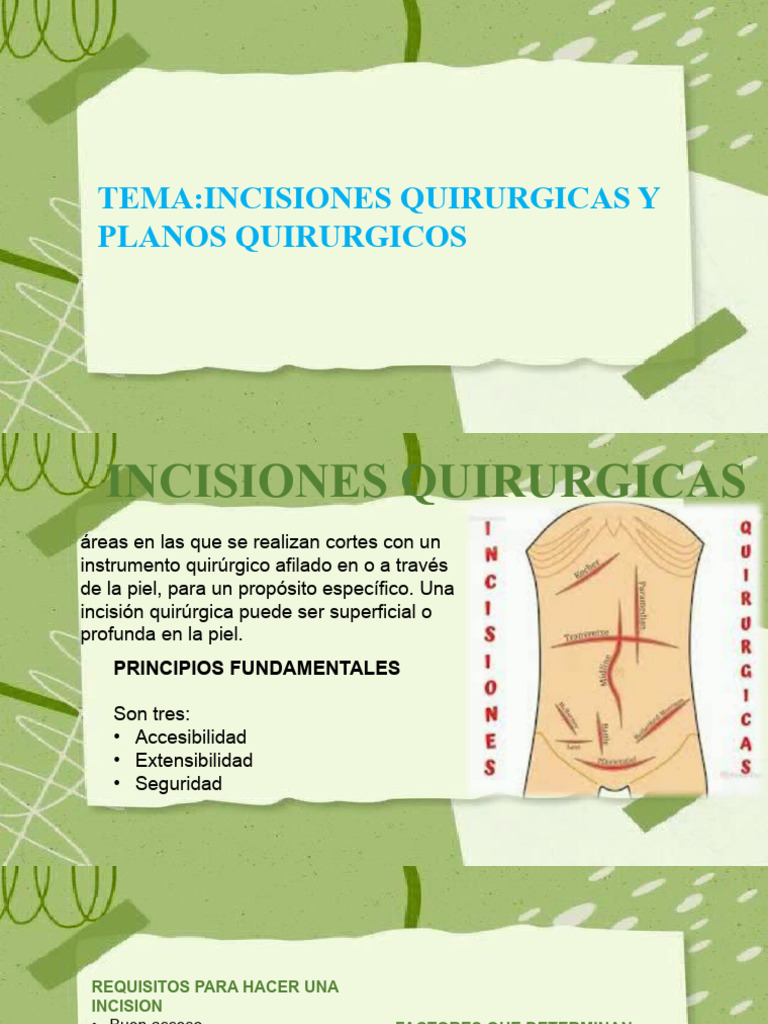 Tipos y Planos de Incisiones Quirúrgicas | PDF | Abdomen | Cirugía