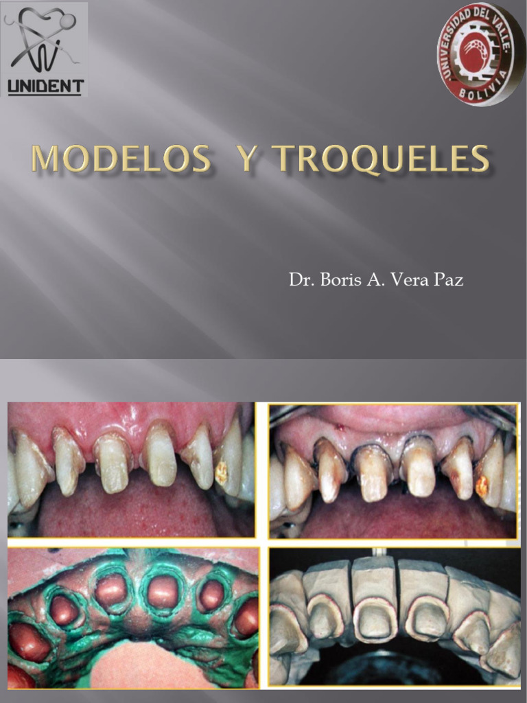 MODELOS Y TROQUELES | PDF | Dentadura postiza