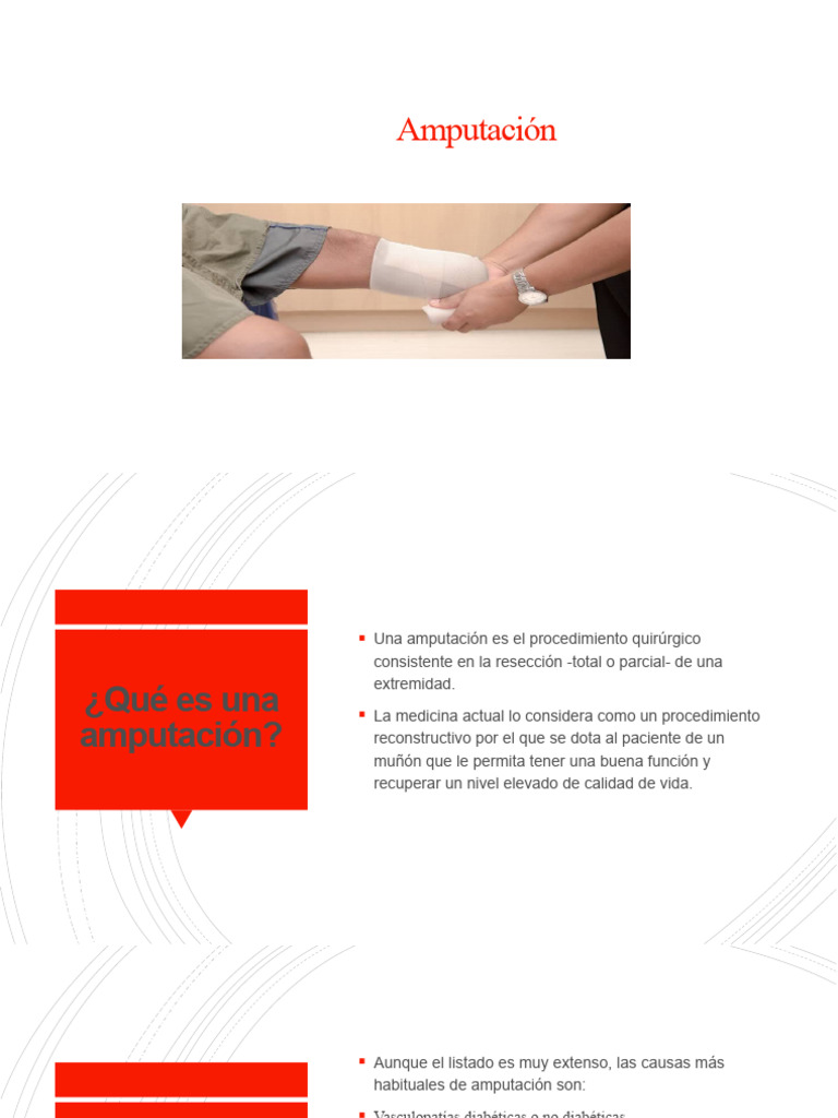 Amputacion | PDF | Amputación | Cirugía
