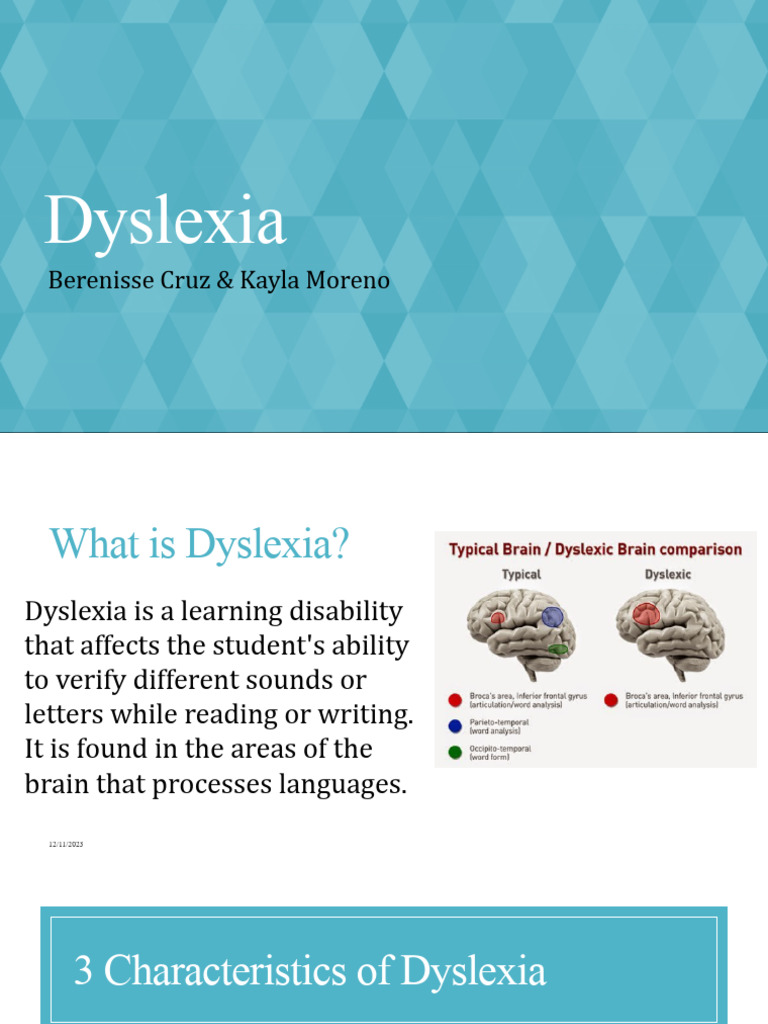 Dyslexia | PDF | Dyslexia | Special Education