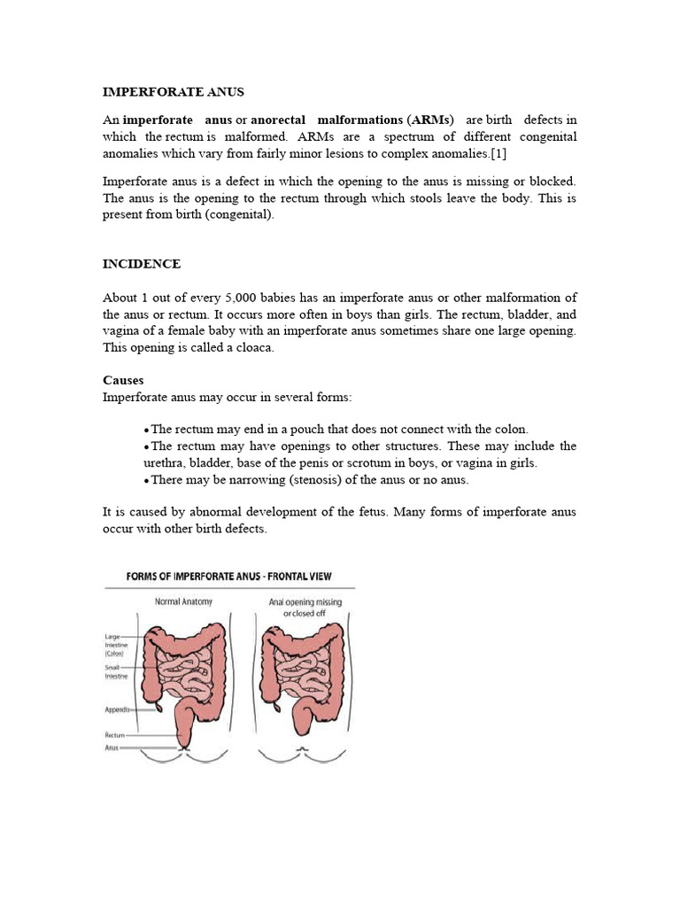 Imperforate Anus | PDF | Medical Specialties | Anatomy