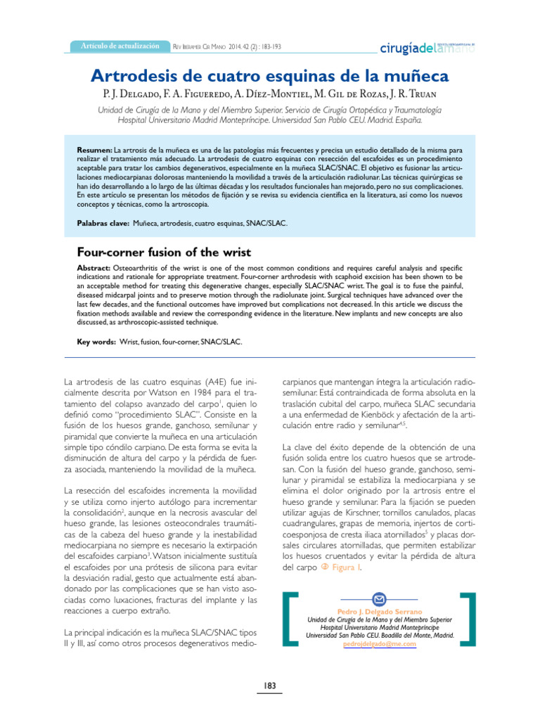 Artrodesis de Cuatro Esquinas de La Muñeca: Four-Corner Fusion of The ...