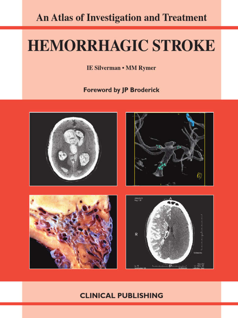 An Atlas of Investigation and Treatment-Hemorrhagic Stroke | PDF ...