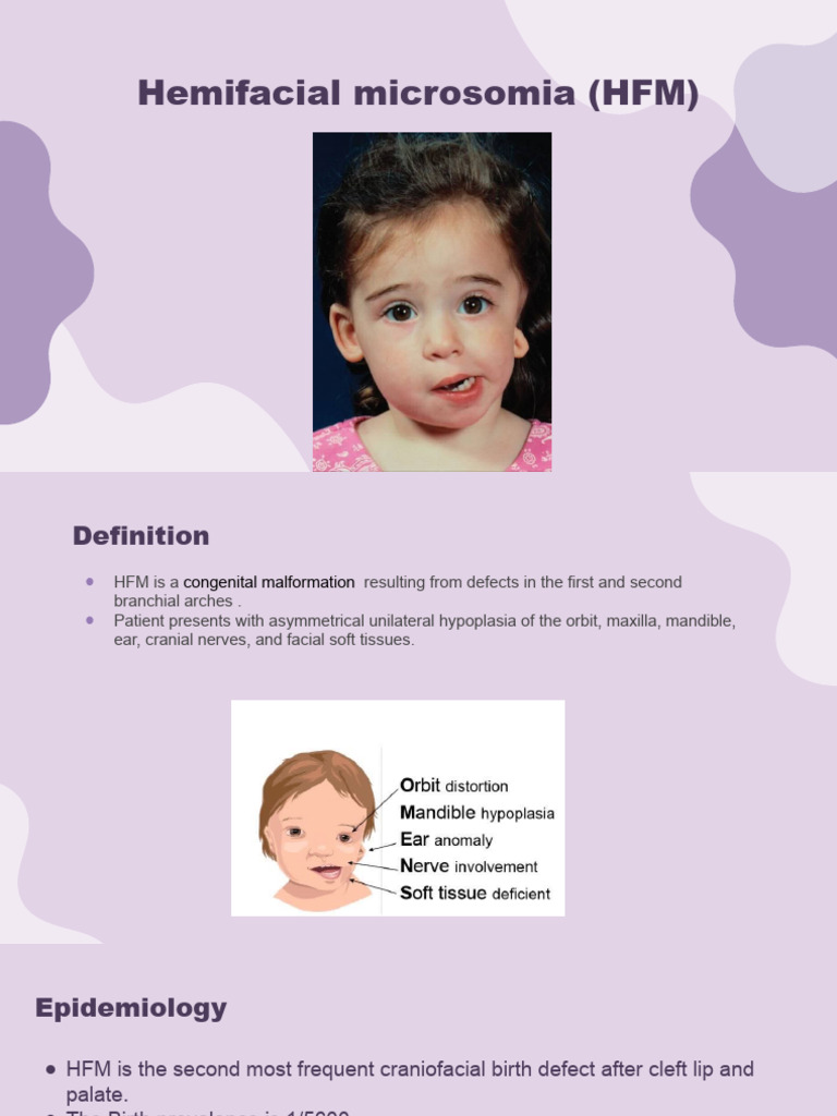 Understanding Hemifacial Microsomia | PDF | Clinical Medicine ...