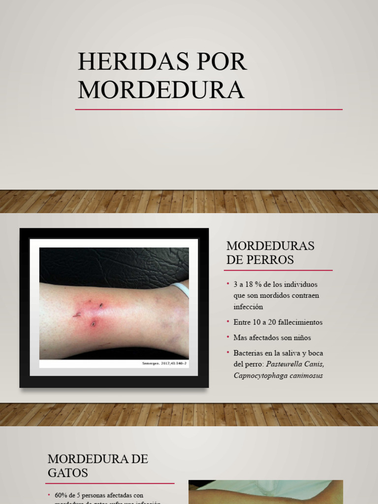 Rabia Heridas Por Mordedura Pdf