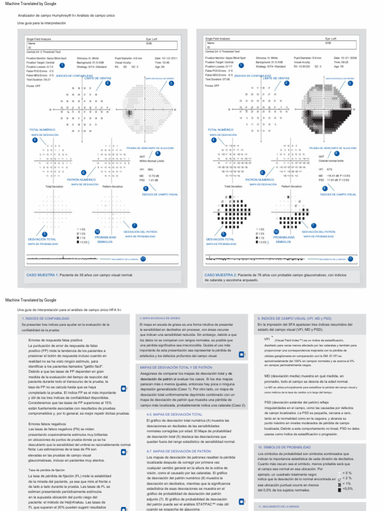 Humphrey Field Analyzer A Guide Zeiss | PDF