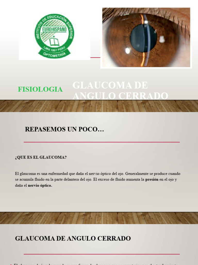 GLAUCOMA DE ANGULO CERRADO | PDF | Glaucoma | Ojo humano