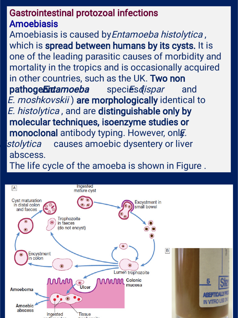 Amebiasis Ana Giardiasis | PDF | Causes Of Death | Gastroenterology