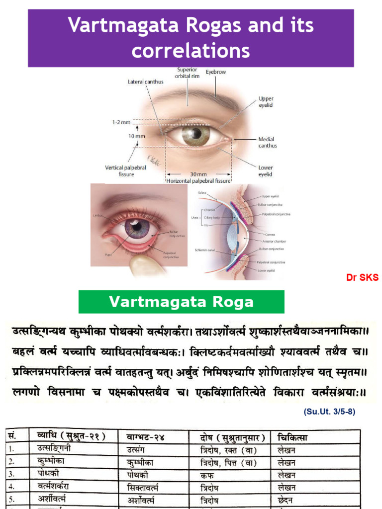 Vartmagata Netra Roga | PDF | Medicine | Human Eye