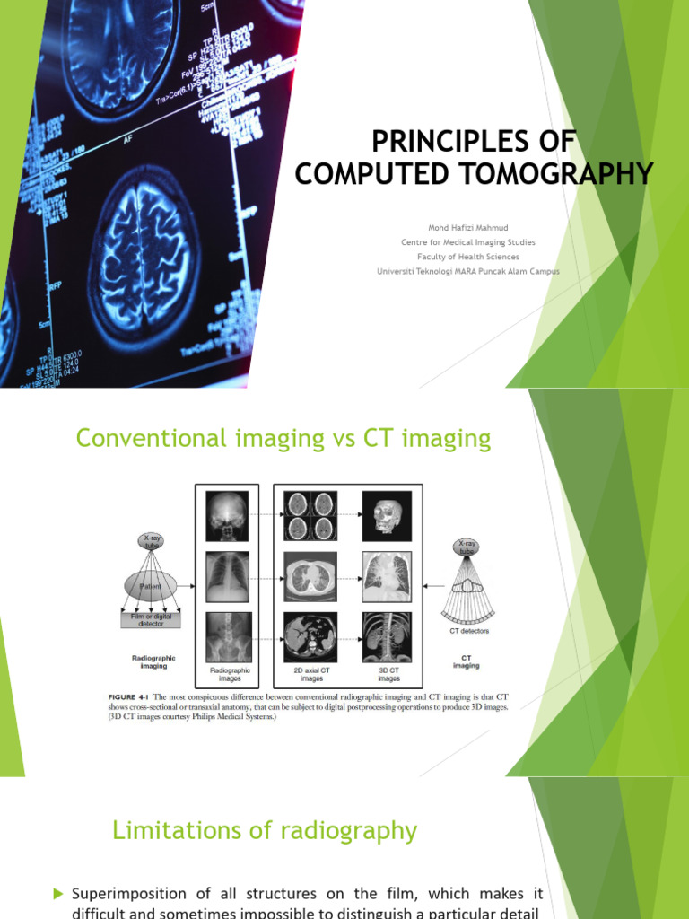 Document 39 | PDF | Ct Scan | Attenuation