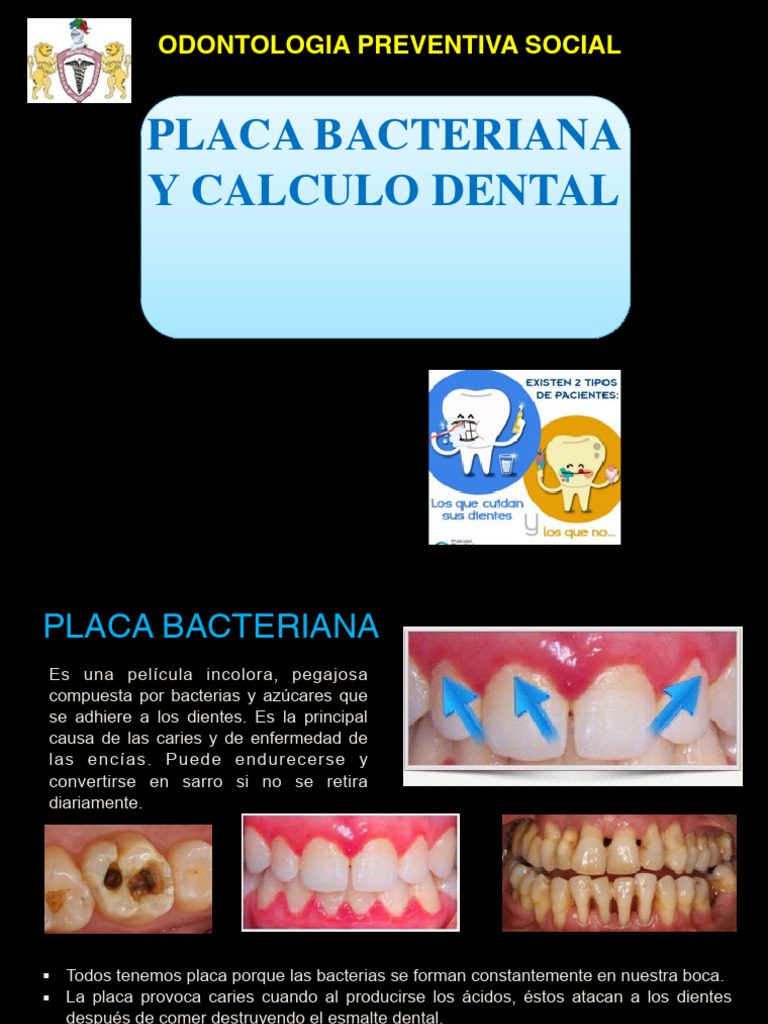 Placa Bacteriana y Calculo | PDF
