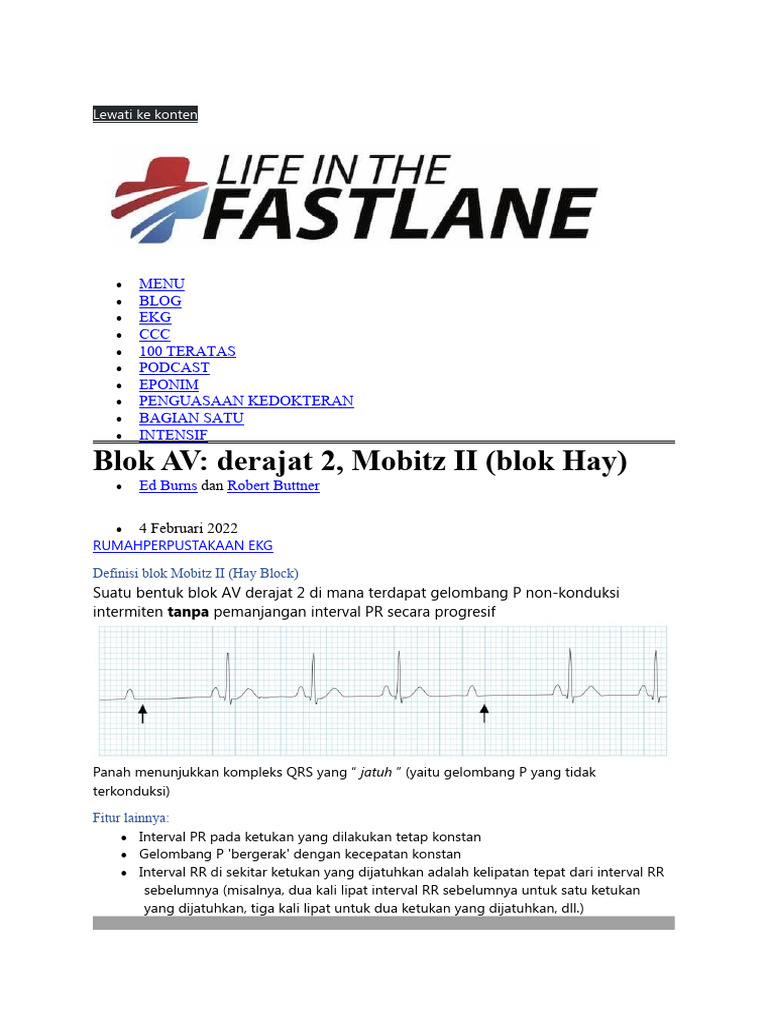 Blok AV: Derajat 2, Mobitz II (Blok Hay) | PDF
