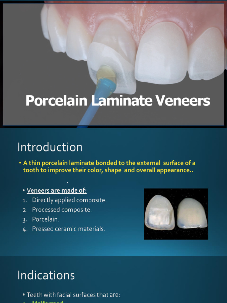 Labial Veneers - Summary | PDF | Dentistry Branches