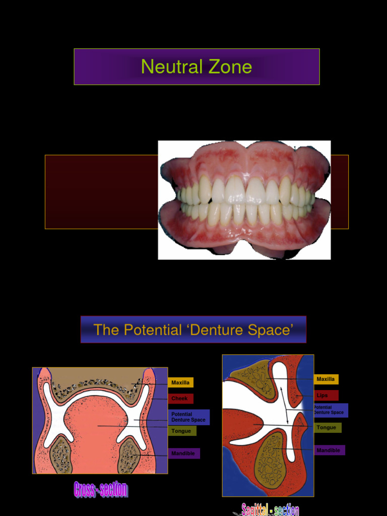 7 Neutral Zone | PDF | Dentures | Human Head And Neck