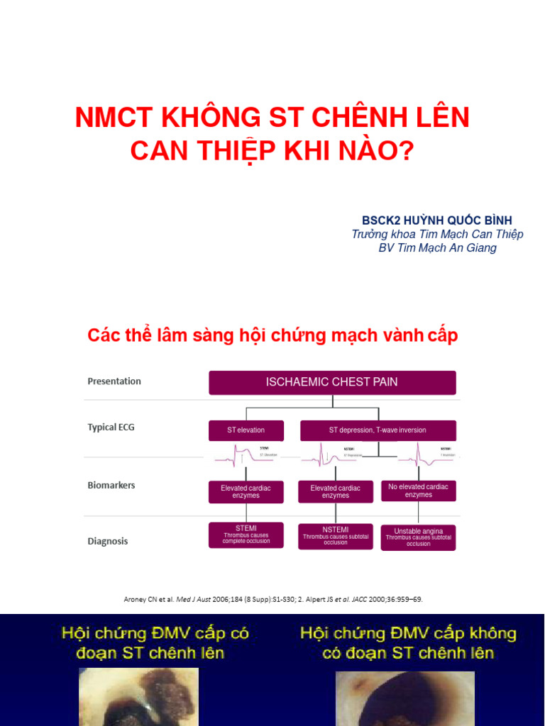 Nmct Không St Chênh Lên Can Thiệp Khi Nào?: Bsck2 Huỳnh Quốc Bình | PDF