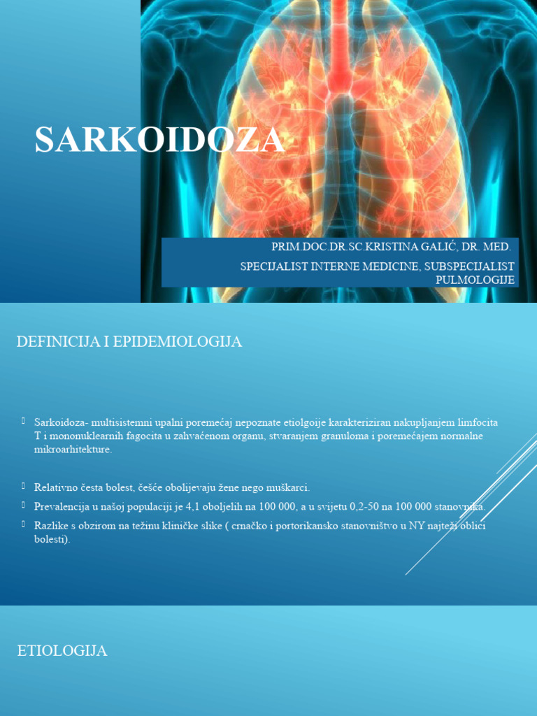 Sarkoidoza 2023 | PDF