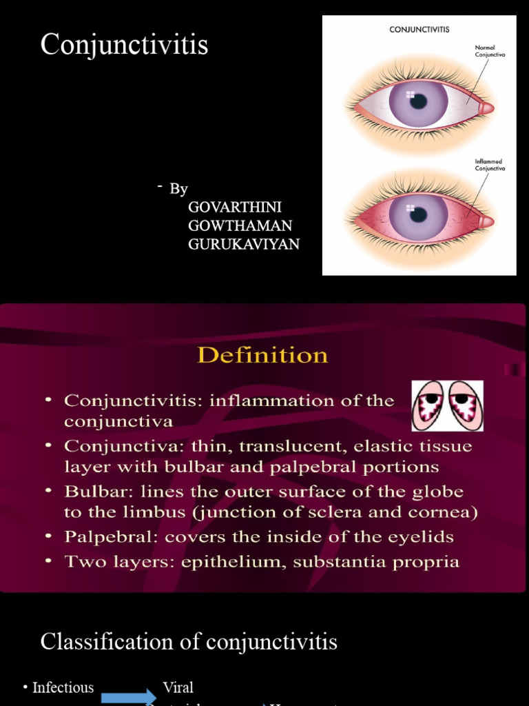 Conjunctivitis | PDF | Science & Mathematics