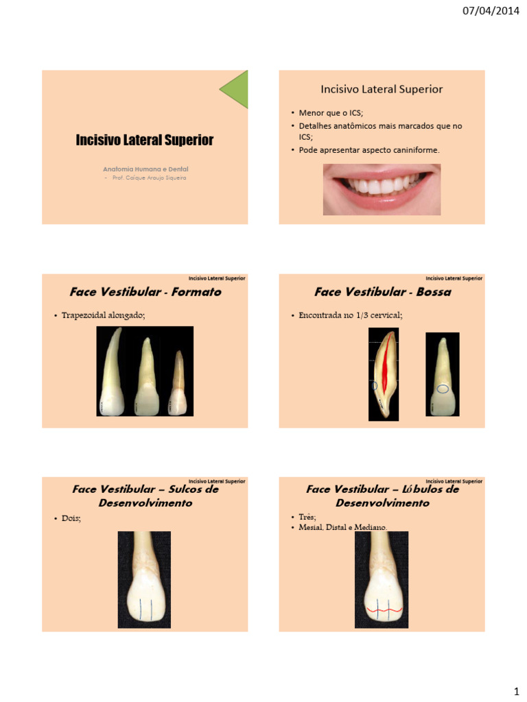 Aula 07 - Incisivo Lateral Superior | PDF | Dente | Anatomia dental