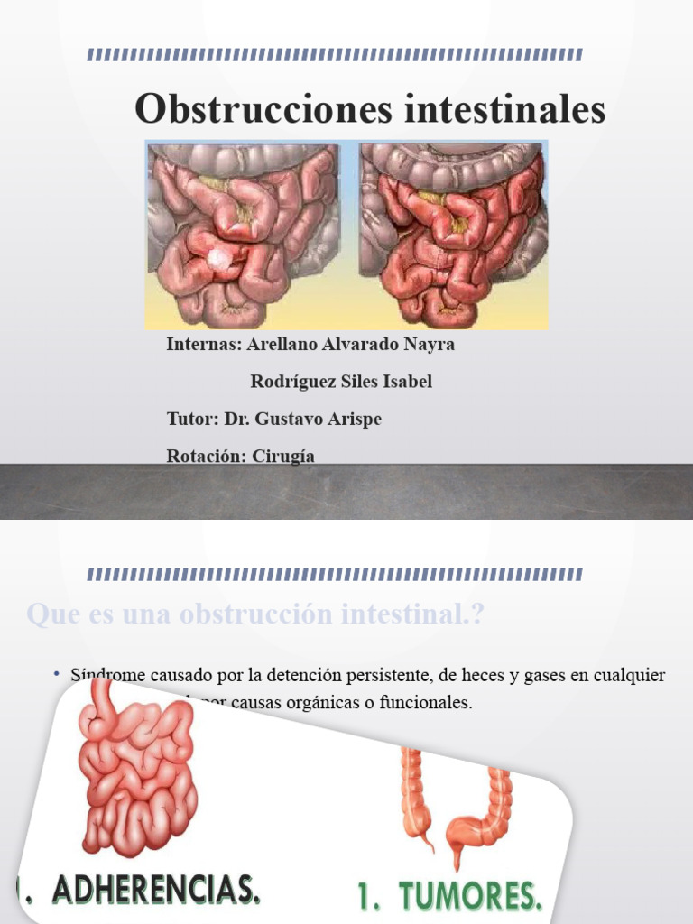Causas y Tratamiento de Obstrucciones Intestinales | PDF | Tracto ...