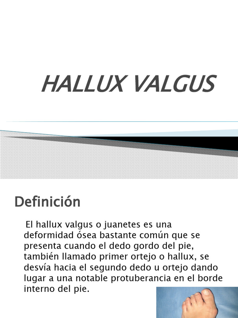 Hallux Valgus | PDF | Dedo del pie | Enfermedades y trastornos