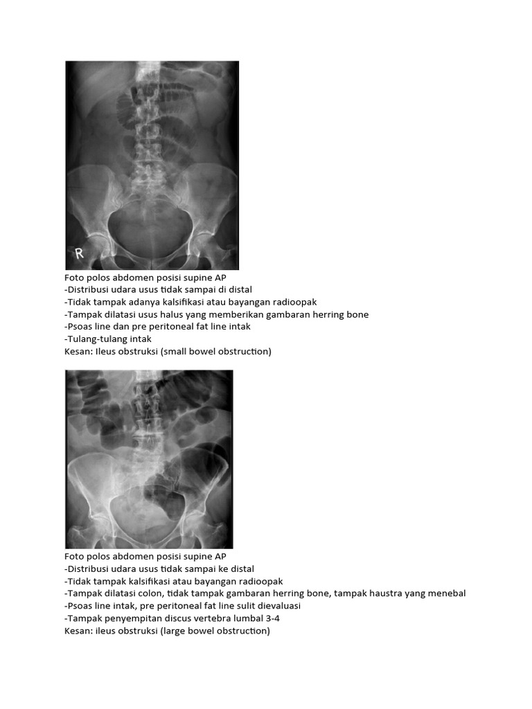 Latihan Abdomen Radiologi | PDF