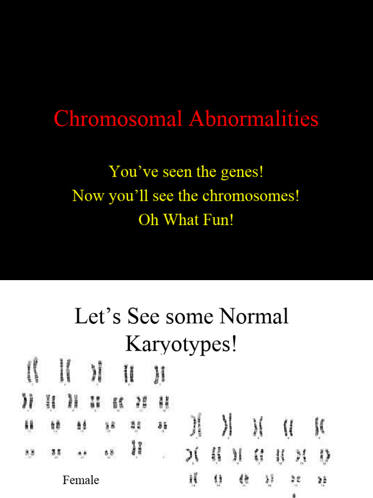 Chromosomal Abnormalities | PDF | Down Syndrome | Syndrome