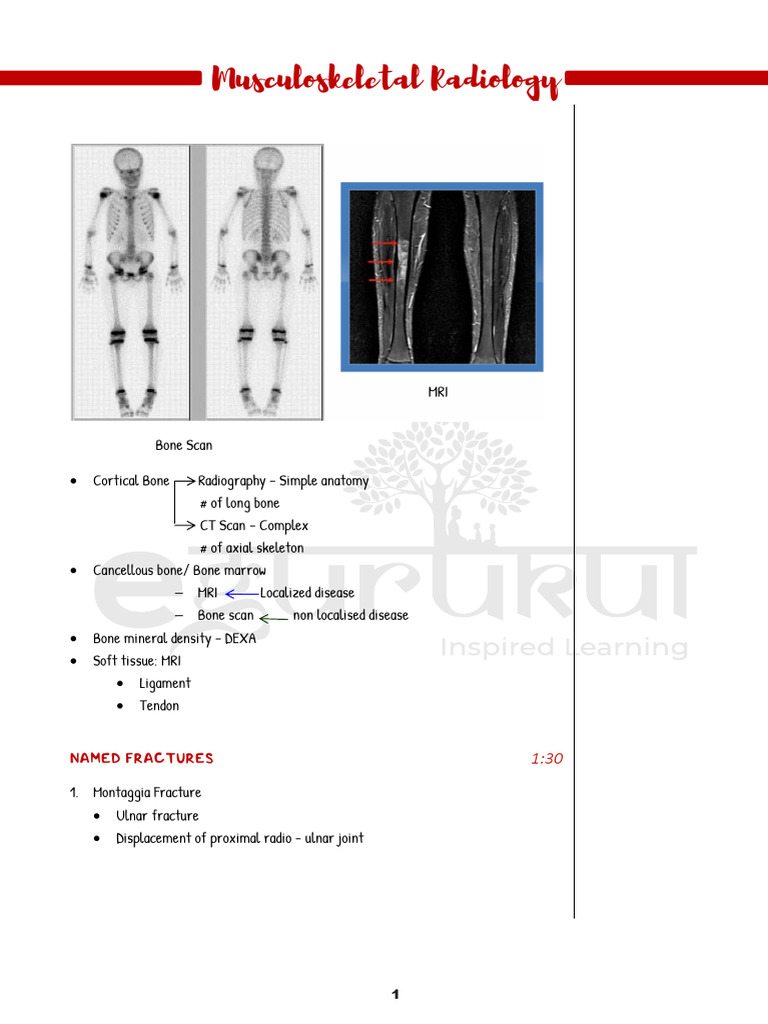 16 - Musculoskeletal Radiology | PDF | Bone | Vertebral Column