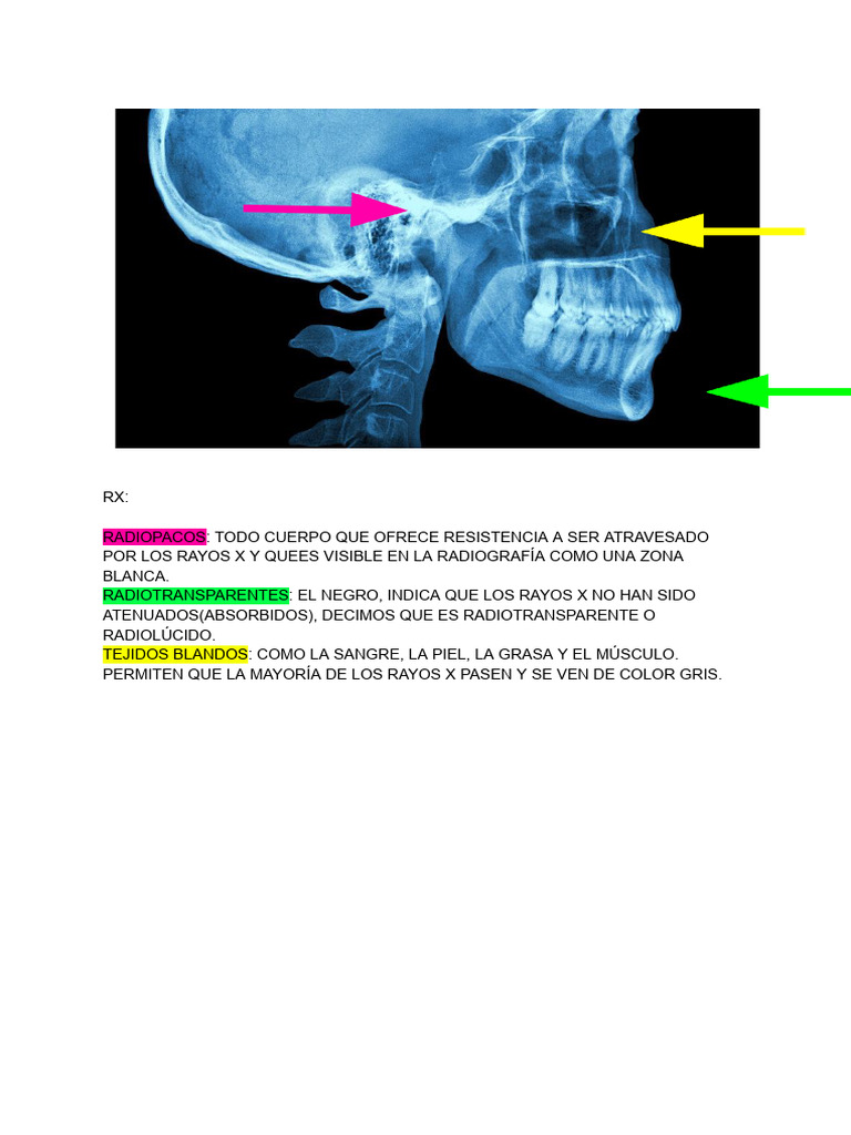 Actividad2 UD2 (B2) | PDF