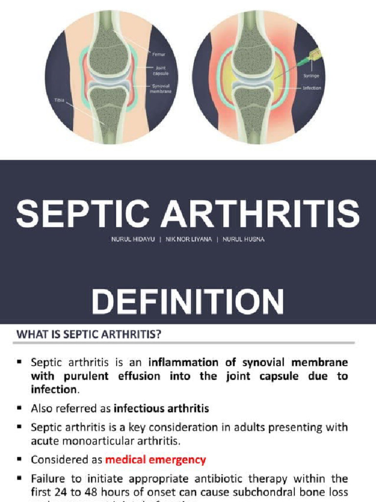 2- Acute Suppurative Arthritis-Septic Arthritis | PDF