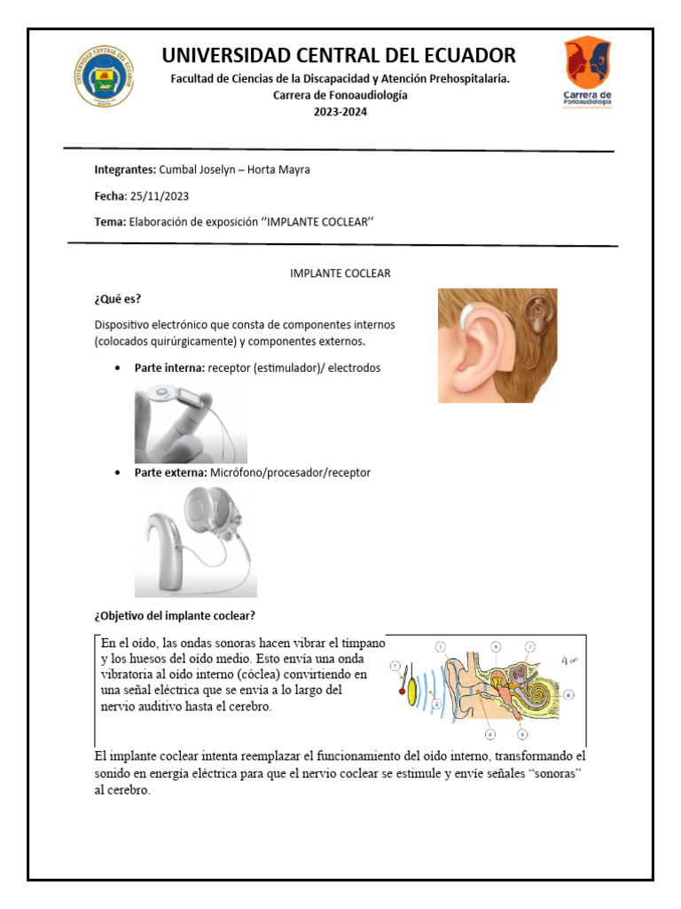 Implante Coclear | PDF | Oído | Neurociencia