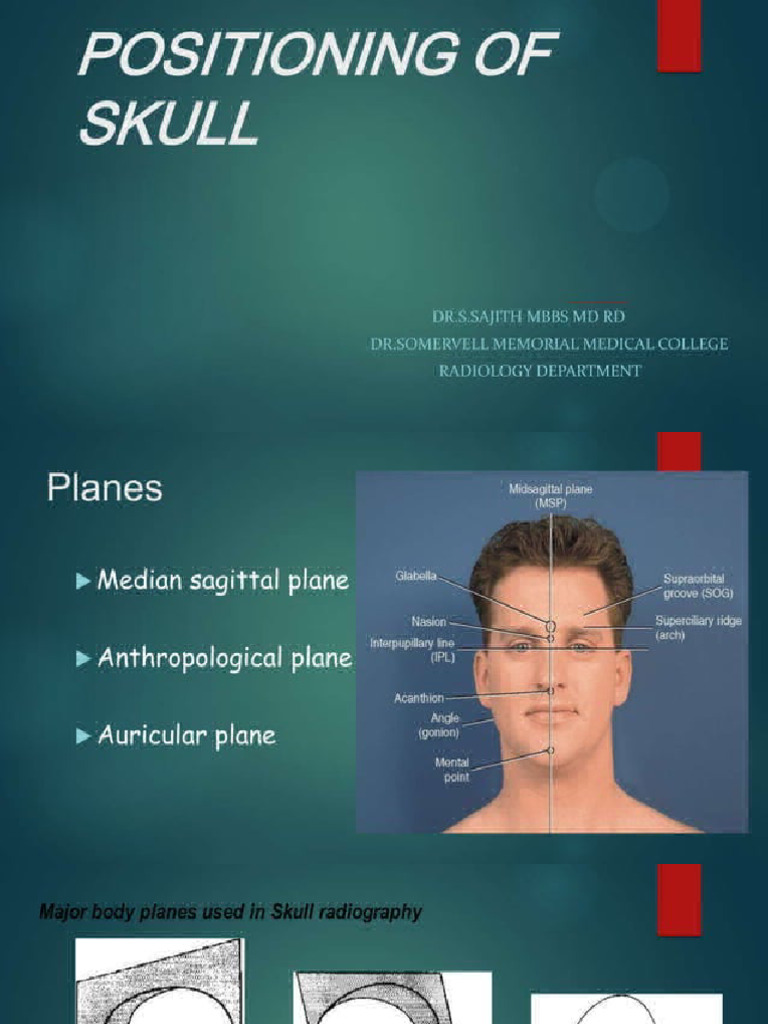 Skull Radiography | PDF