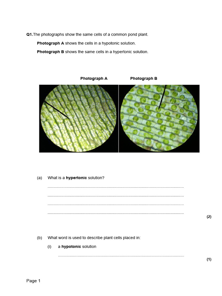 Osmosis Exam Question 1gy2ady | PDF | Osmosis | Cell Biology